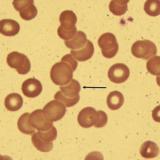 Examination of the Cardiac Apex Beat • Mediscuss • Algorithm for Apical ...